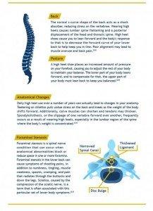 See How Wearing High Heels Brings Danger to Your Whole Body